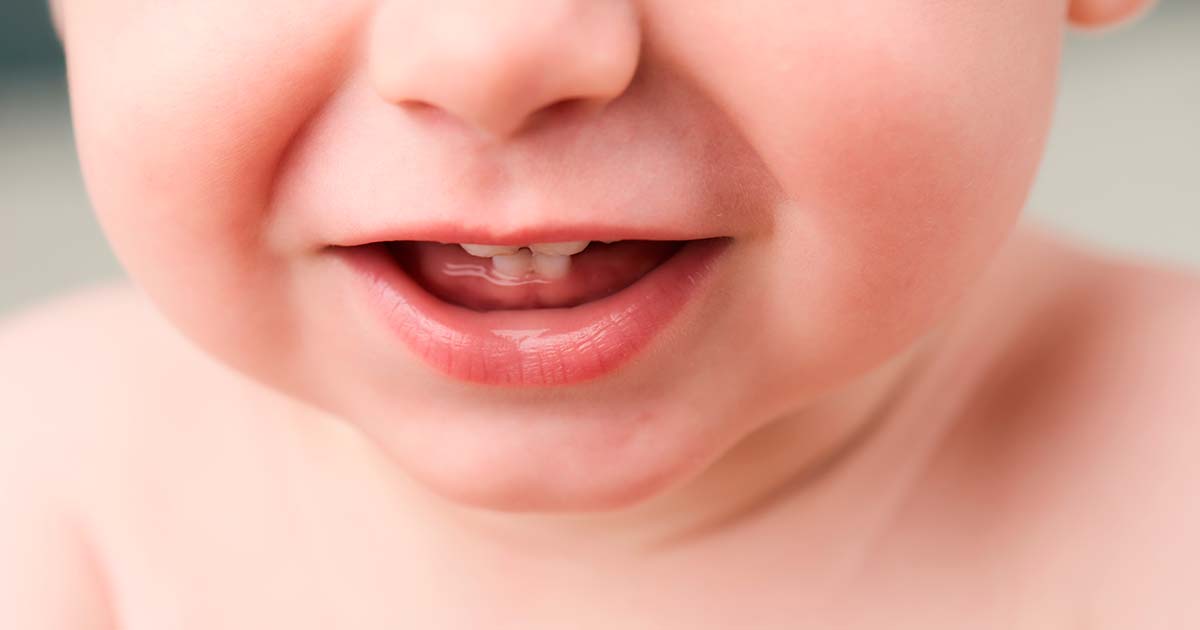 Caries en bebés: Revisiones desde el primer diente - Dental Aguilar