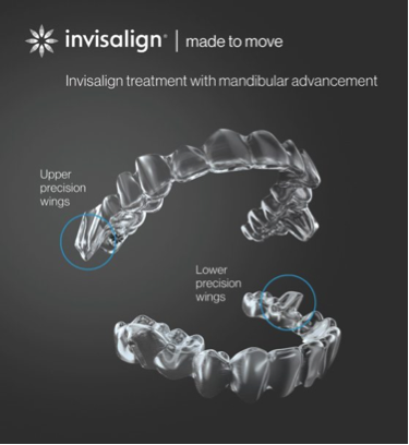 Dispositivo de avance mandibular Invisalign adolescentes en Barcelona